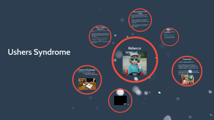 Ushers Syndrome by Jillian Wheaton on Prezi