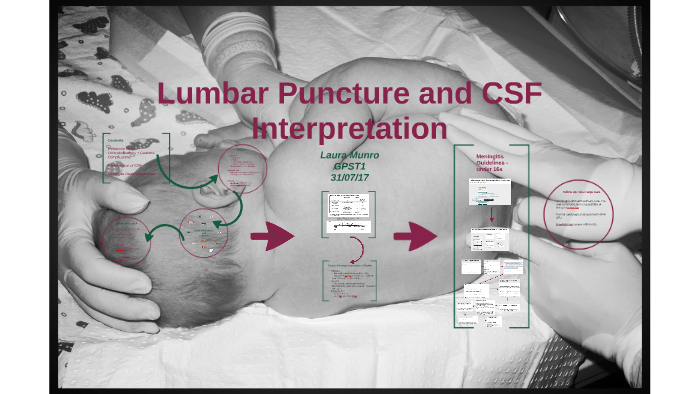 Lumbar Puncture and CSF Interpretation by Laura Munro on Prezi