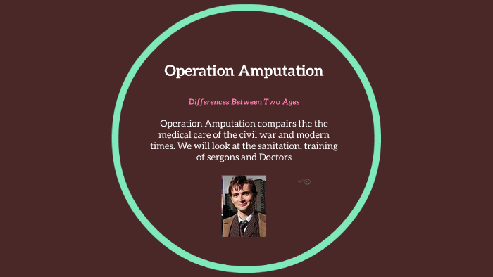 Operation Amputation by Sarah Genzer