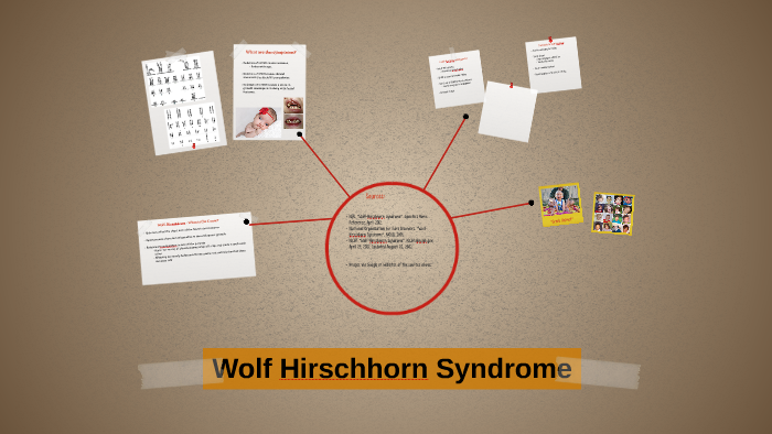 Wolf Hirschhorn Syndrome by Karisa Krueger on Prezi