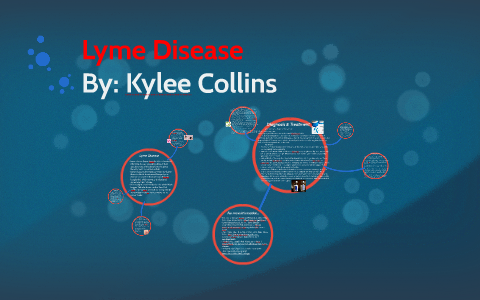 Lyme Disease by Kylee Collins on Prezi
