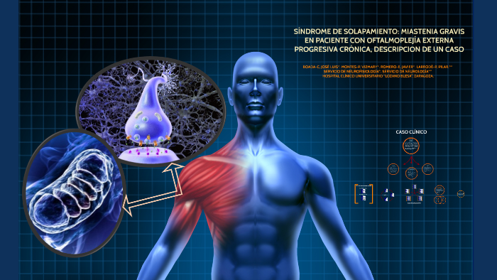 overlapping syndrome by vizmary montes on Prezi