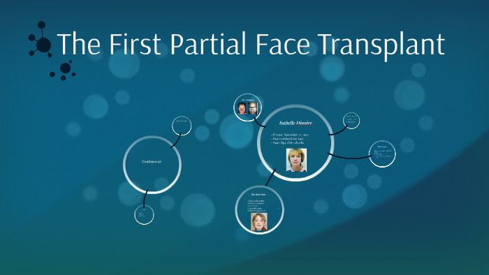 The First Partial Face Transplant by Calais Galbraith on Prezi