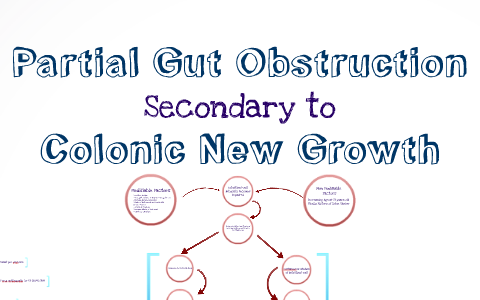 Partial Gut Obstruction Secondary to Colonic New Growth by Jaisus Rio ...