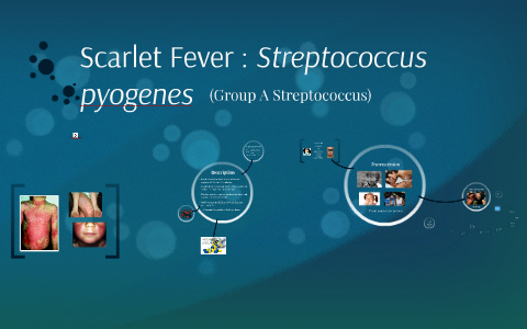 Scarlet Fever : Group A Streptococcus (Group A Strep) by Cayley Bell