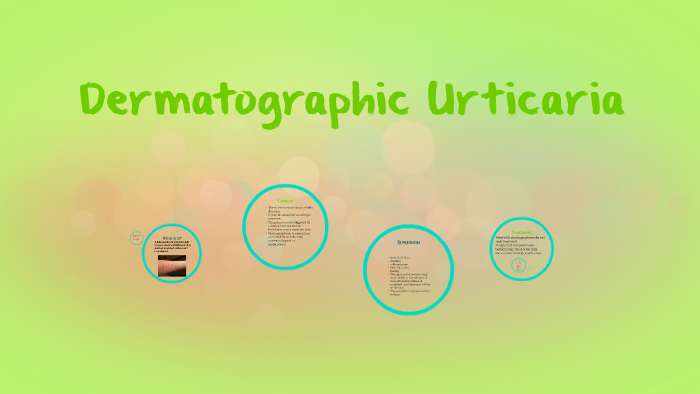 Dermatographic Urticaria by Katie Kelly on Prezi