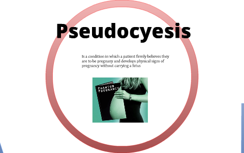 Pseudocyesis by Kelsea McCoy on Prezi