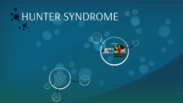 Hunter Syndrome by Tej P on Prezi