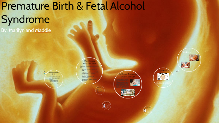 Premature Birth & Fetal Alcohol Syndrome by Maddie West on Prezi