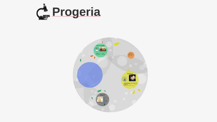 Progeria by Therese Perucho on Prezi