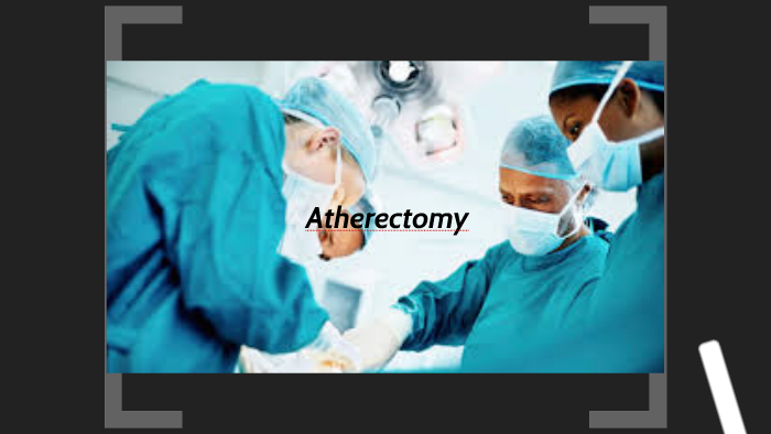 Directional atherectomy, with the HawkOne™ directional ather by Dérick ...