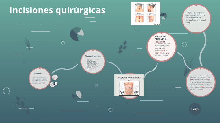 Incisiones quirúrgicas by Josue Narvaez on Prezi