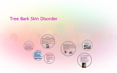Tree Bark Skin Disease by Katie Thomas on Prezi