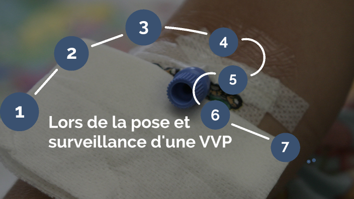 lors de la pose et surveillance d'une vvp by Bryan Deniel on Prezi