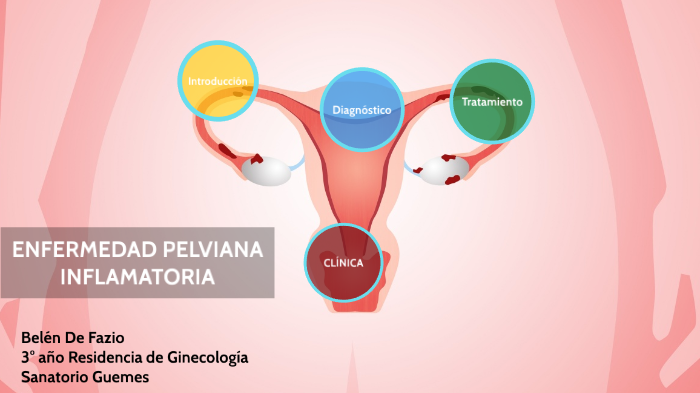 Enfermedad pélvica inflamatoria by Belén De Fazio on Prezi