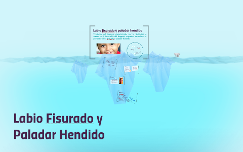 Labio Fisurado y Paladar Hendido by on Prezi