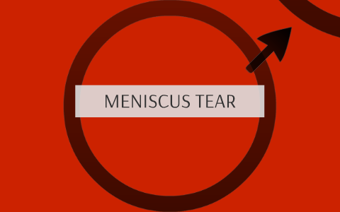 MENISCUS TEAR by kathe traore on Prezi