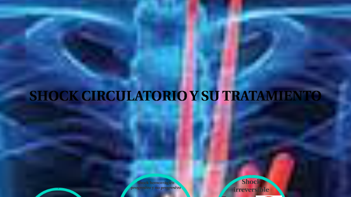 Shock circulatorio y su tratamiento by Lizz Martinez on Prezi