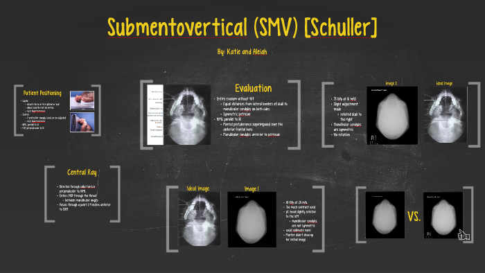 Submentovertical (SMV) Projection by Aleiah Parcero on Prezi