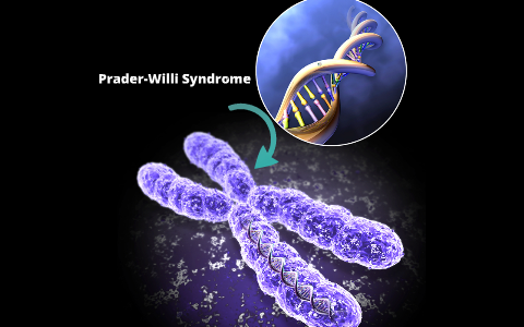 Prada-Willi Syndrome by Jaan Marion on Prezi
