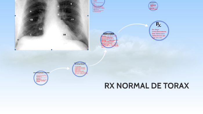 RX NORMAL DE TORAX by franco manfredi on Prezi