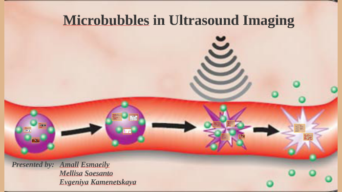 Microbubbles in ultrasound imaging by Giovanni Mellisa Soesanto on Prezi