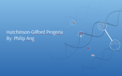 Progeria by Philip Ang on Prezi