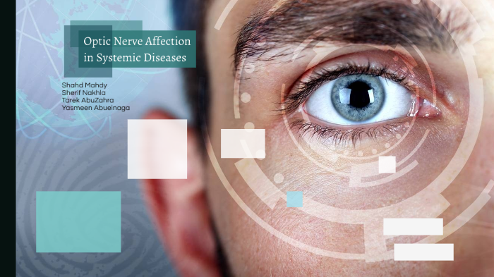 Optic Nerve Affection in Systemic Diseases by Yasmeen Abuelnaga on Prezi