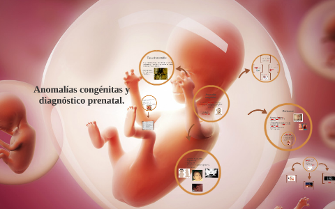 Anomalías congénitas y diagnóstico prenatal. by Allison Vasquez on Prezi
