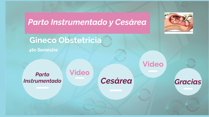 Parto Instrumentado y Cesárea by Karla Gamiz on Prezi