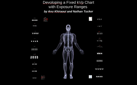 Developing a Fixed kVp Chart with Exposure Ranges by Anu Khiraoui on Prezi