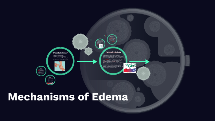 Mechanisms of Edema by Quentin Espinosa on Prezi