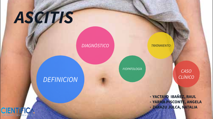 ASCITIS by raul yactayo on Prezi