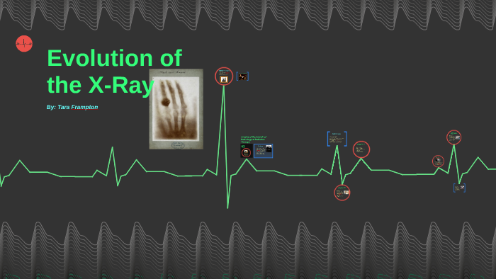 Evolution of the X-Ray by Tara Frampton on Prezi