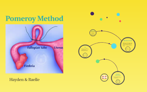 Pomeroy Method by raelle kinnee on Prezi