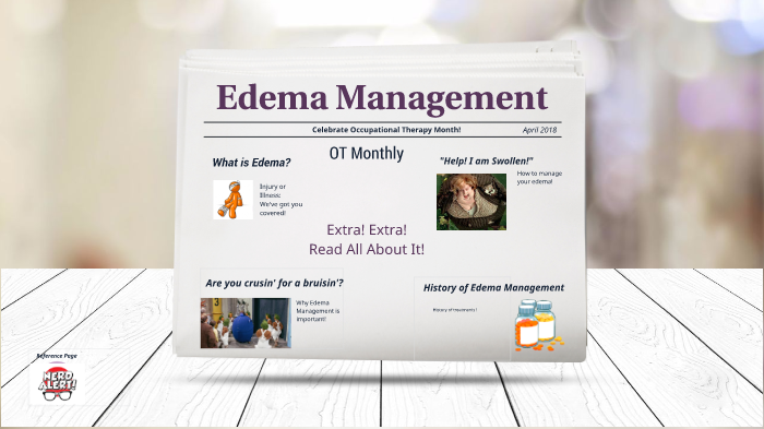 Edema Management by Aspen G on Prezi