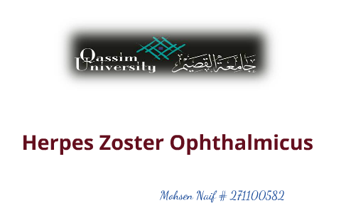 Herpes Zoster Ophthalmicus by Mohsen Alenezi on Prezi