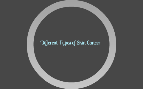 Skin Cancer Informative Speech by Jenna Svoboda on Prezi