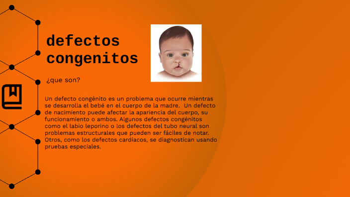 defectos congénitos by natalia alvarez on Prezi