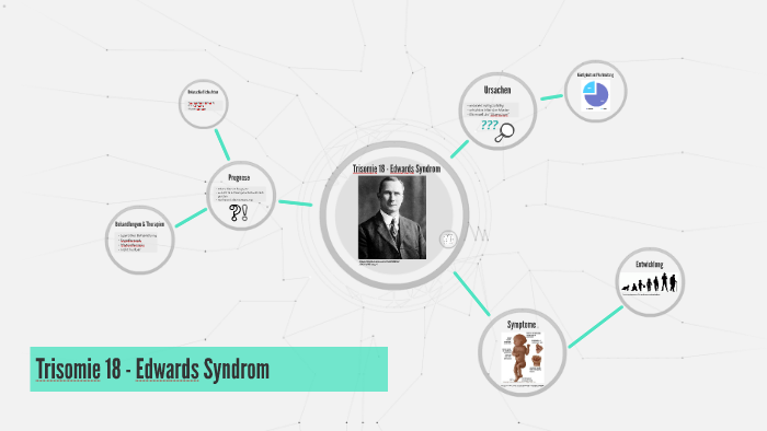 Trisomie 18 - Edwards Syndrom by Laura Künz on Prezi