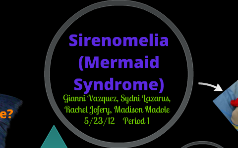 Mutations - Sirenomelia (Mermaid Syndrome) by Frank Iero on Prezi