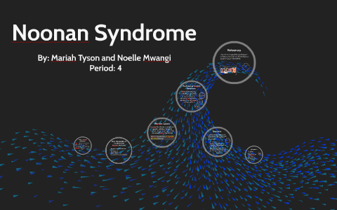 Noonan Syndrome by Mariah Tyson on Prezi