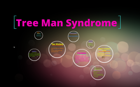 Tree Man Syndrome by Joslynn LaRock on Prezi