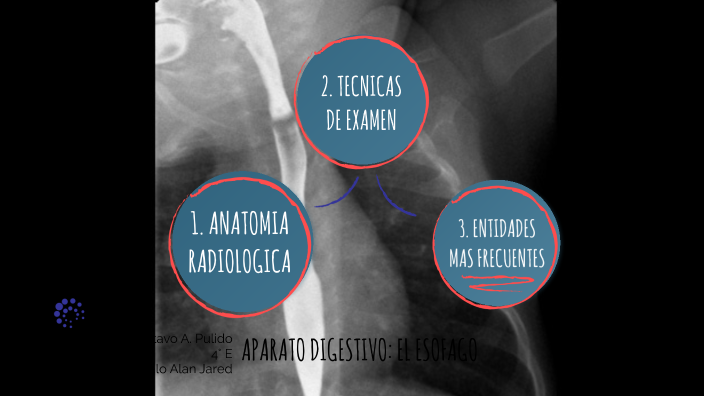 Cap.23 Radiología APARATO DIGESTIVO: EL ESOFAGO by Alan Galo on Prezi