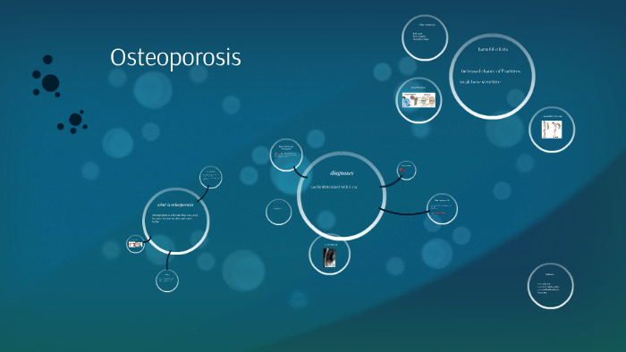Osteoporosis by joshua Soper on Prezi