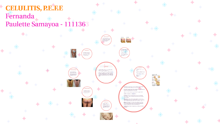 CELULITIS, P.E.F.E by paulette samayoa on Prezi