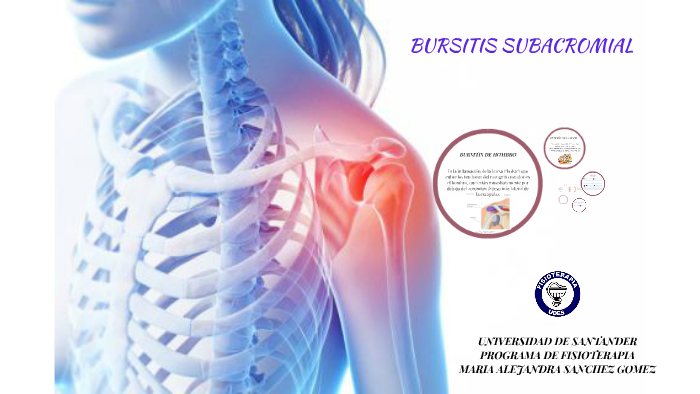 BURSITIS DE HOMBRO by Maria Alejandra Sanchez Gomez on Prezi