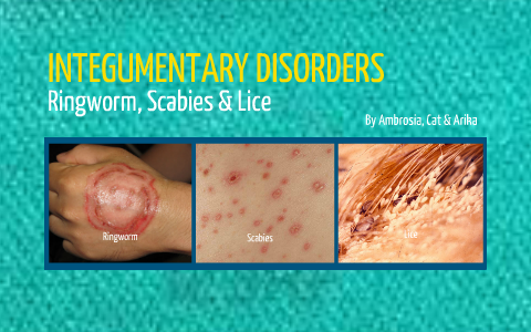 Integumentary Disorders by Ambrosia Haines on Prezi