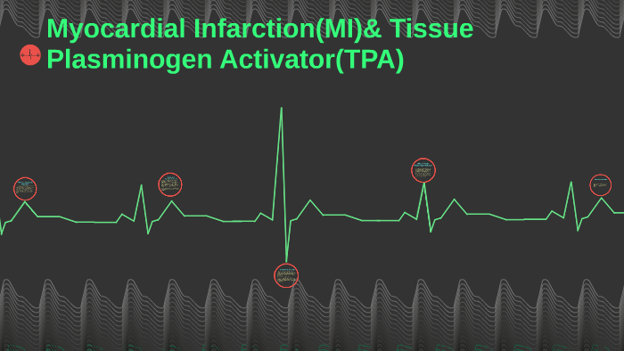 Myocardial Infarction(MI)& Tissue Plasminogen Activator (tPA) by ...