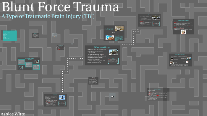 Traumatic Brain Injury (TBI) by Ashlee Witte on Prezi